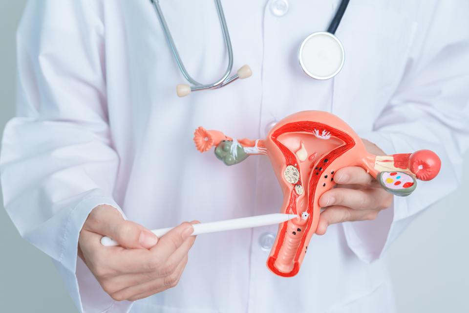 Ugxan Sidaha Fiixda Leh (Polycystic Ovary Syndrome) - Daryeel Magazine